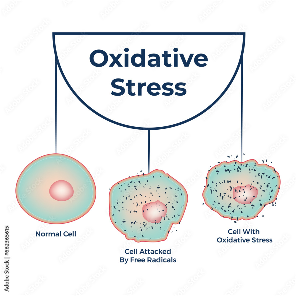 Oxidative Stress. From Normal Cells to Attack Free Radicals and Cell ...