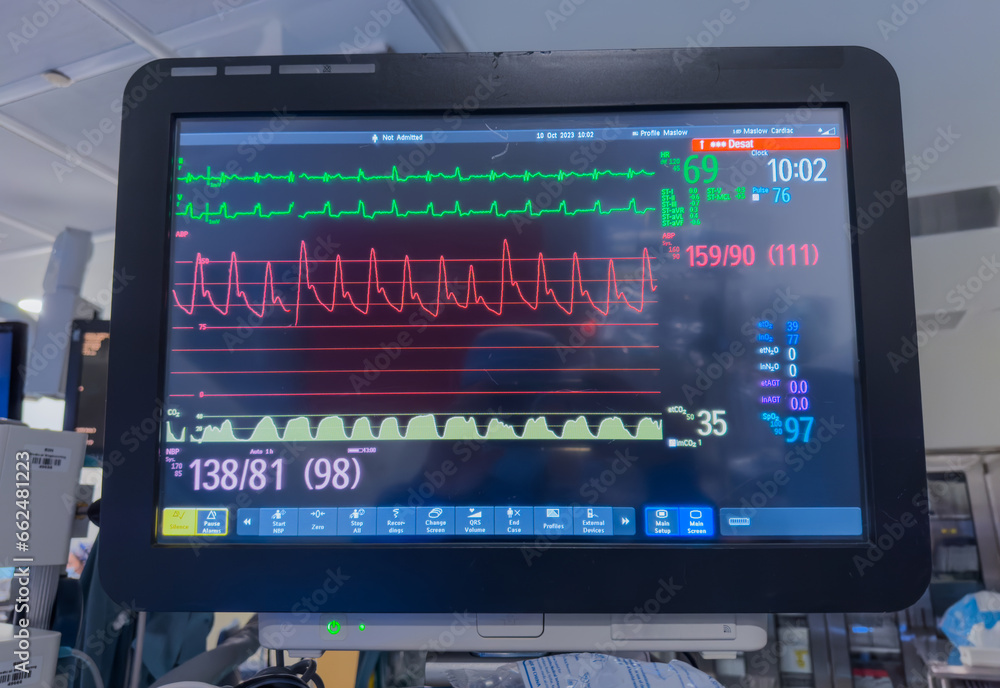 hospital monitor displaying vital signs: heart rate, blood pressure ...