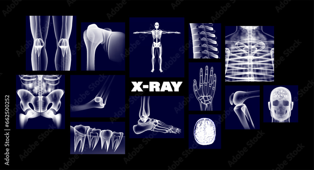 Medical X-ray 3D images of the human body - knee, chest, hip joint ...