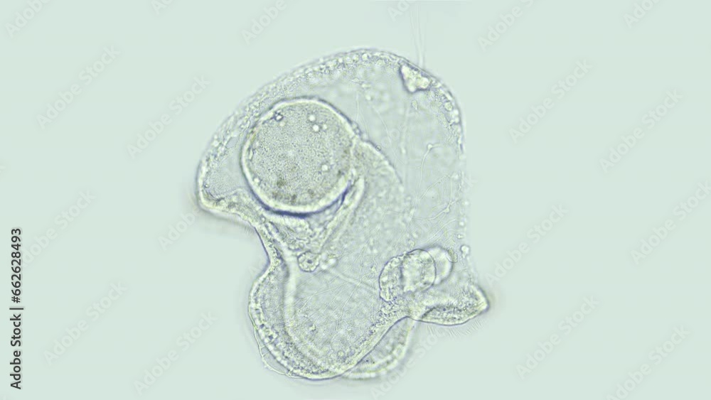 Pilidium larva of worm Heteronemertea under microscope, genus ...