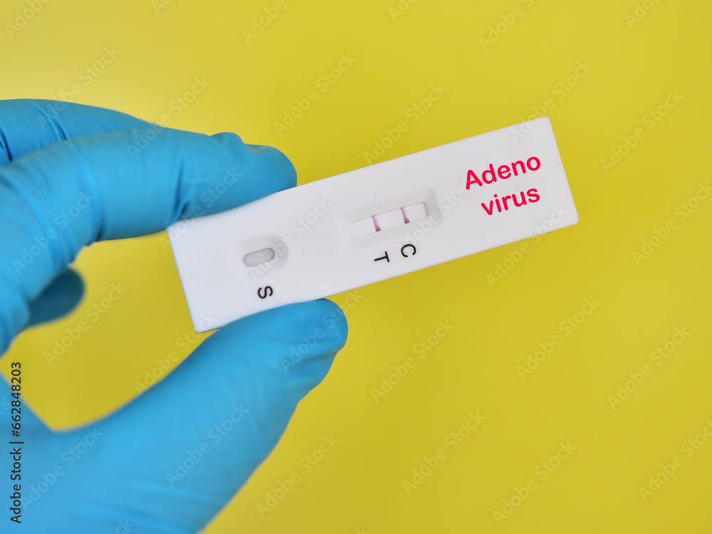 Adenovirus positive test result by using rapid test device Stock Photo ...