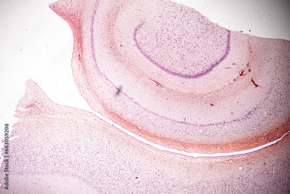 Motor Neuron, Spinal cord, Nerve fibres and nerve cells under the ...