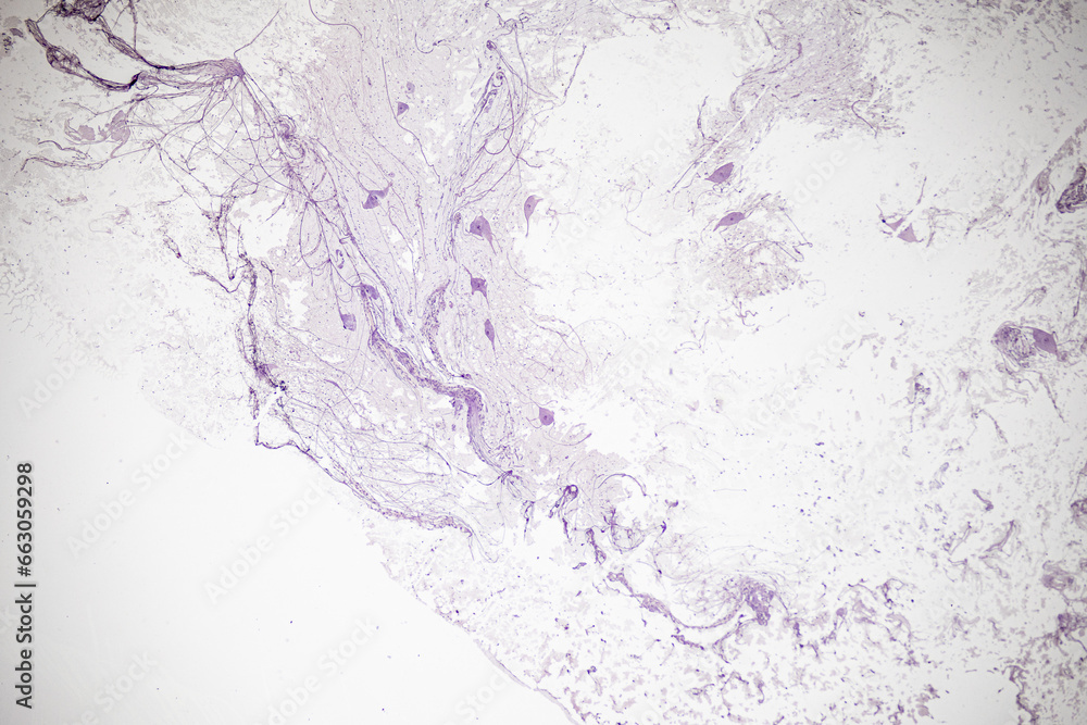 Motor Neuron, Spinal cord, Nerve fibres and nerve cells under the ...