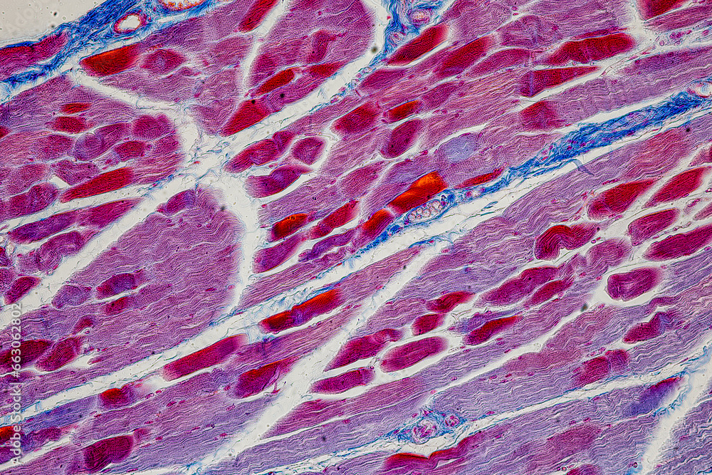 Showing Light micrograph Type of Tissue Human under the microscope in ...