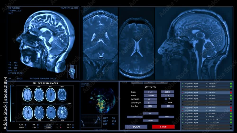 MRI brain scanning animation. Neurology data, vital signs on display ...