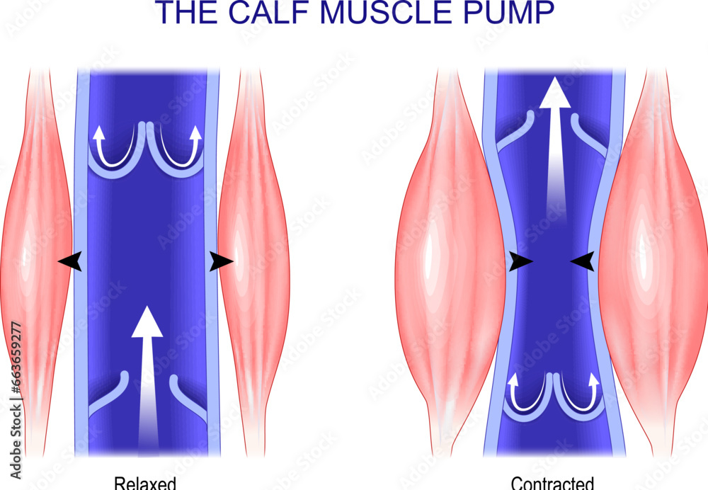 Calf muscle pump. Venous Health. Stock Vector | Adobe Stock