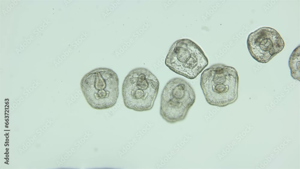 Larvae sea urchin Strongylocentrotus pallidus under microscope, phylum ...