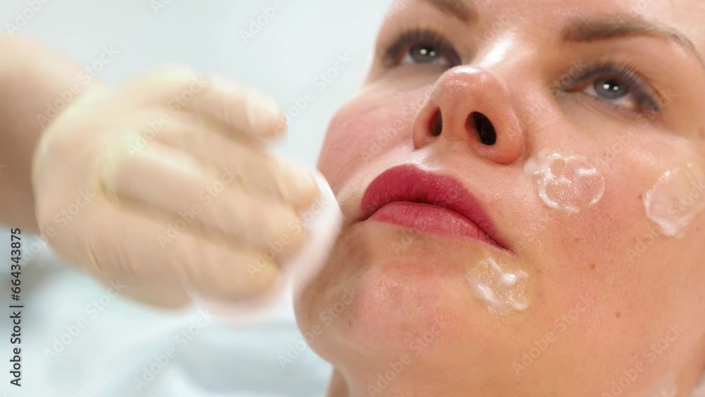 Wipe your face with a cotton pad. Doctor cosmetologist wipes face with ...