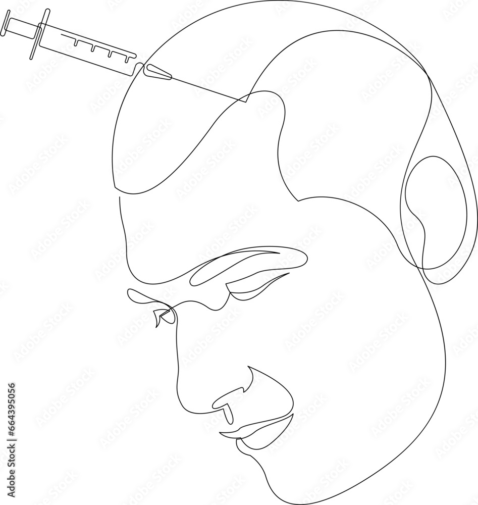 Continuous one line drawing of platelet rich plasma injection procedure ...