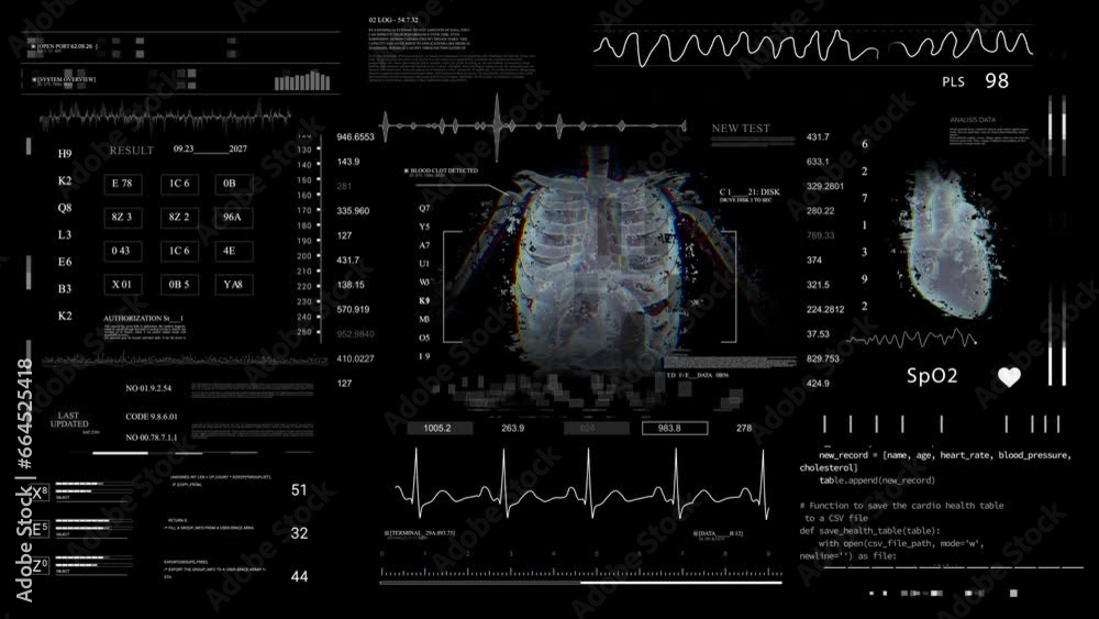 MRI x ray Scan, 3D Model Animation.Medical HUD Analyzing cardiac ...