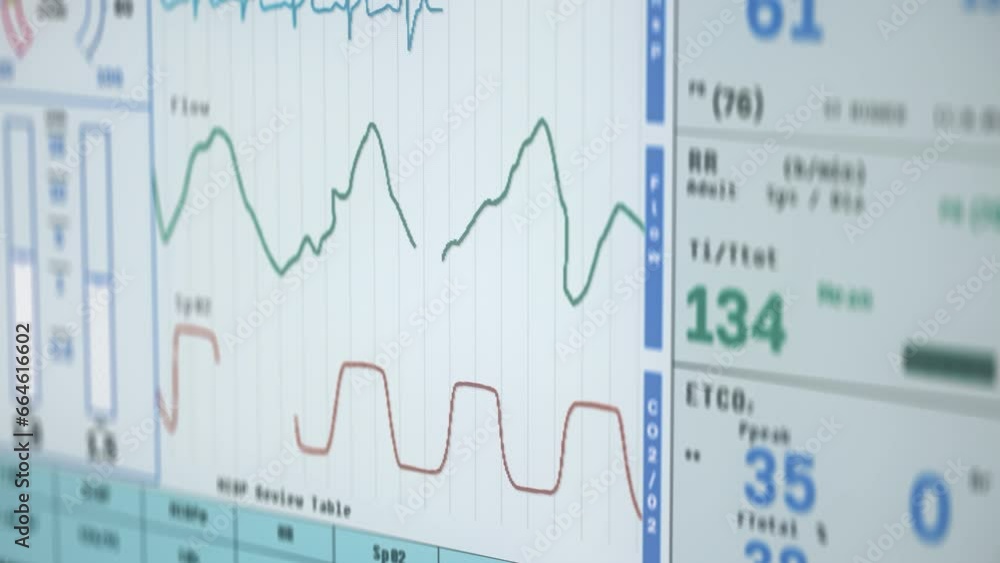 Medical monitoring screen displaying the health markers of a sick ...