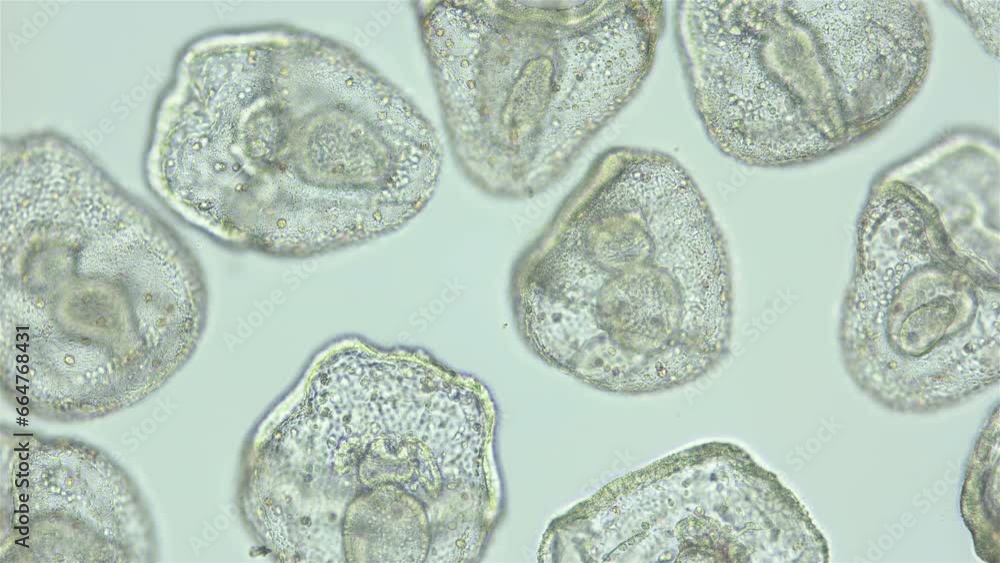 Larvae sea urchin Strongylocentrotus pallidus under microscope, phylum ...