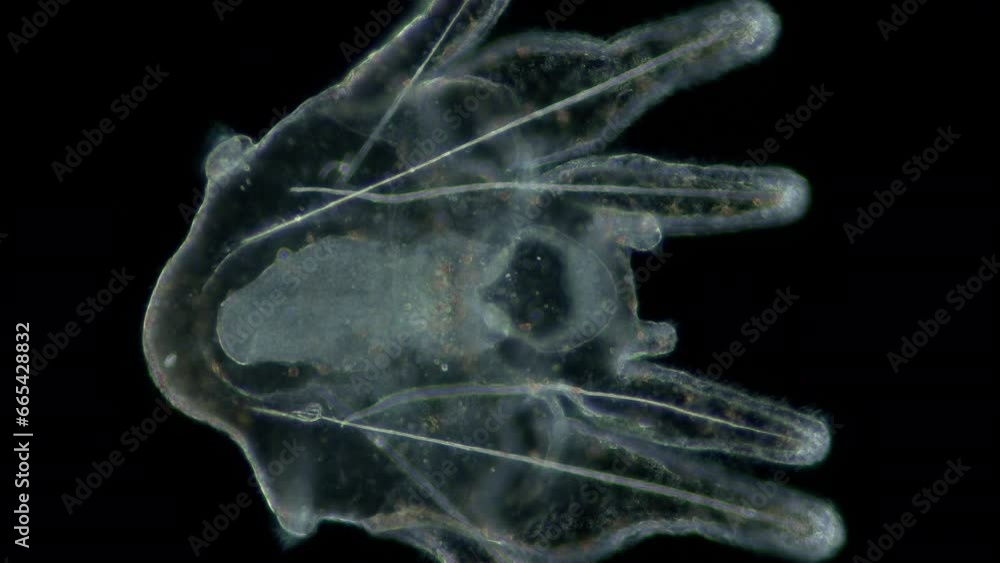 Larva sea urchin Strongylocentrotus pallidus under microscope, phylum ...