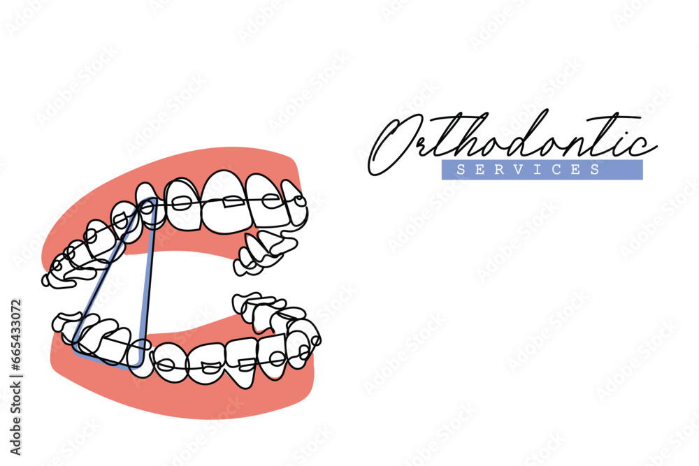 line art of Orthodontic treatment. Dentists day and respect for their services to humanity ...