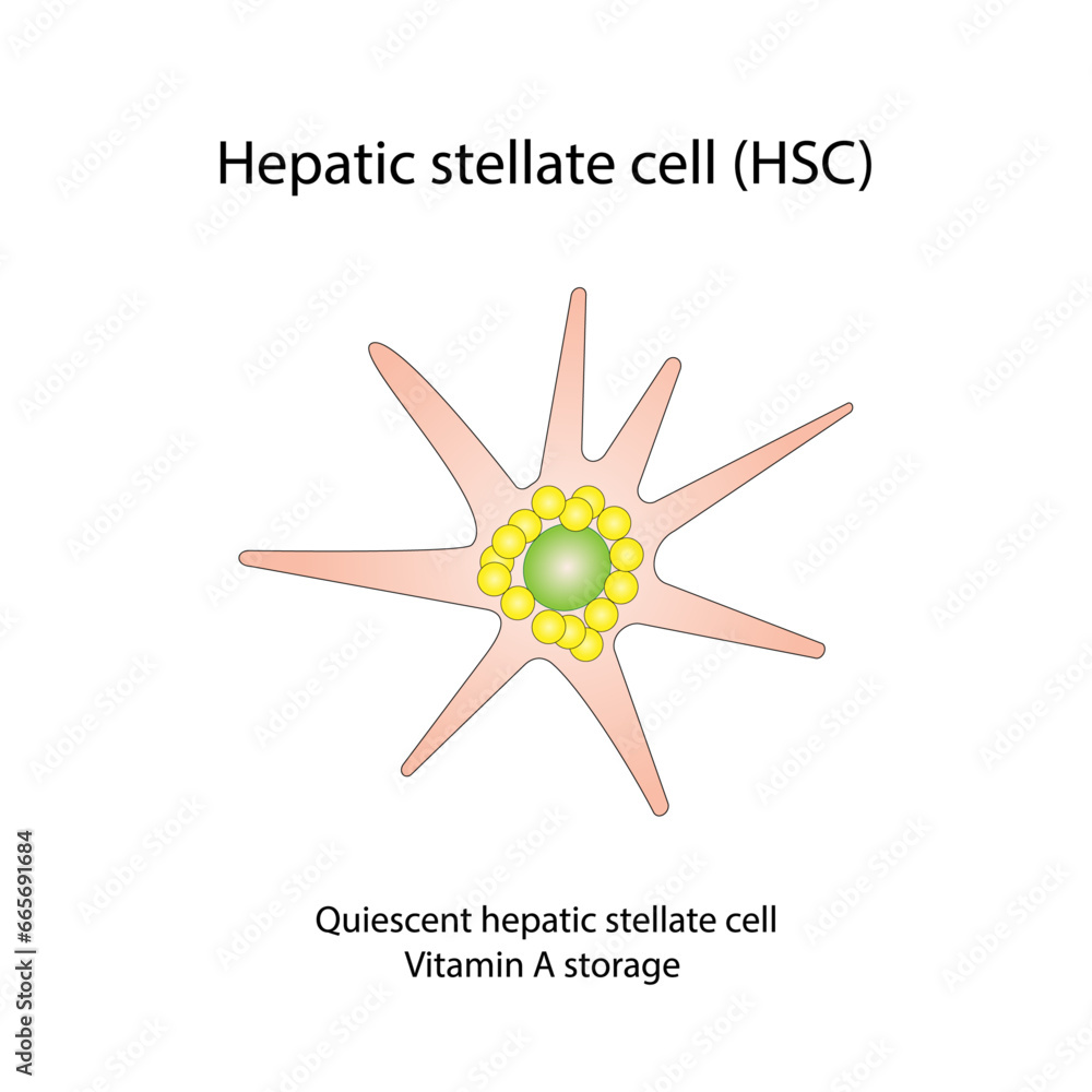 Hepatic stellate cell, HSC. Quiescent HSC vitamin A storage. Hepatic ...