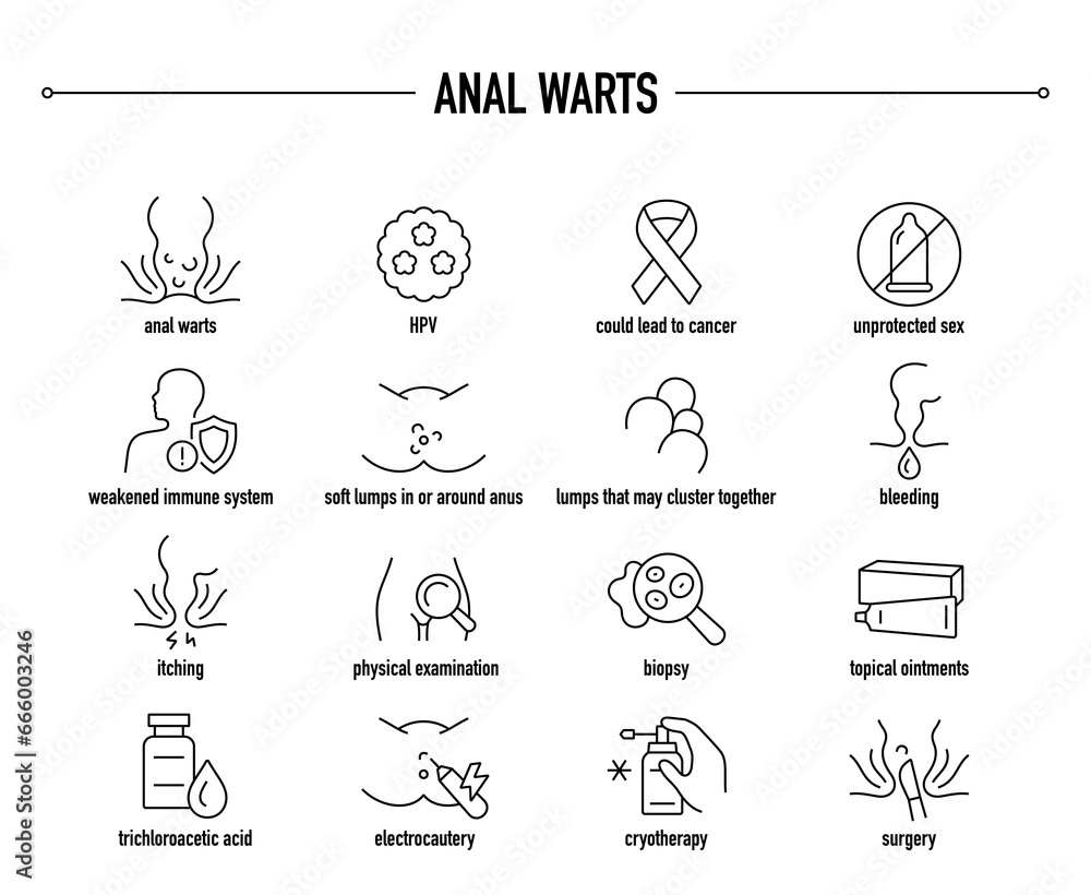 Anal Warts symptoms, diagnostic and treatment vector icons. Line ...