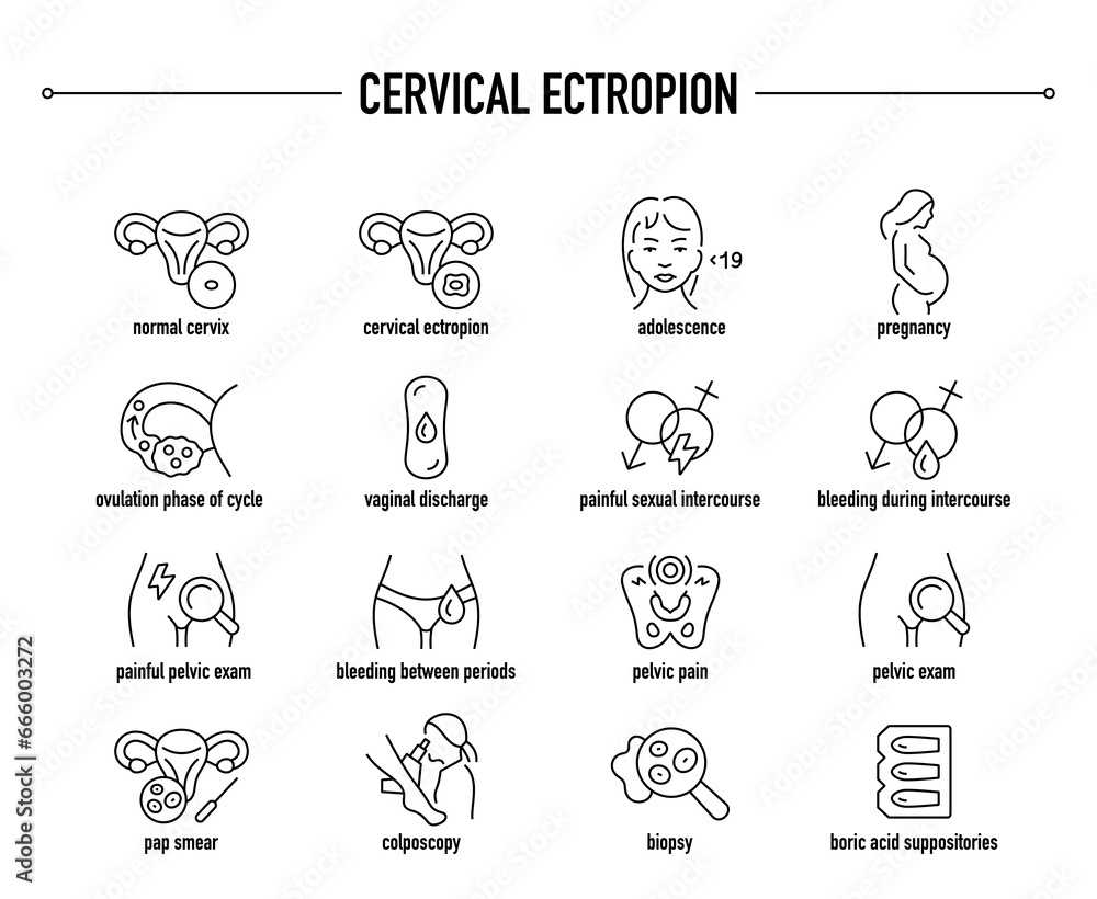 Cervical Ectropion Symptoms Diagnostic And Treatment Vector Icons