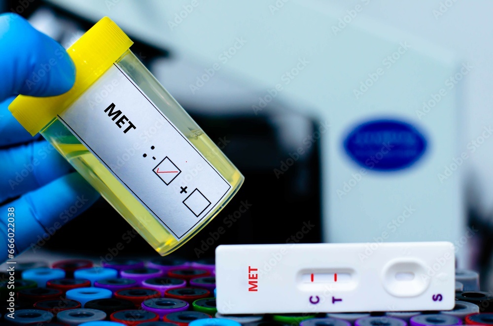 Urine sample of patient negative for methamphetamine by rapid ...