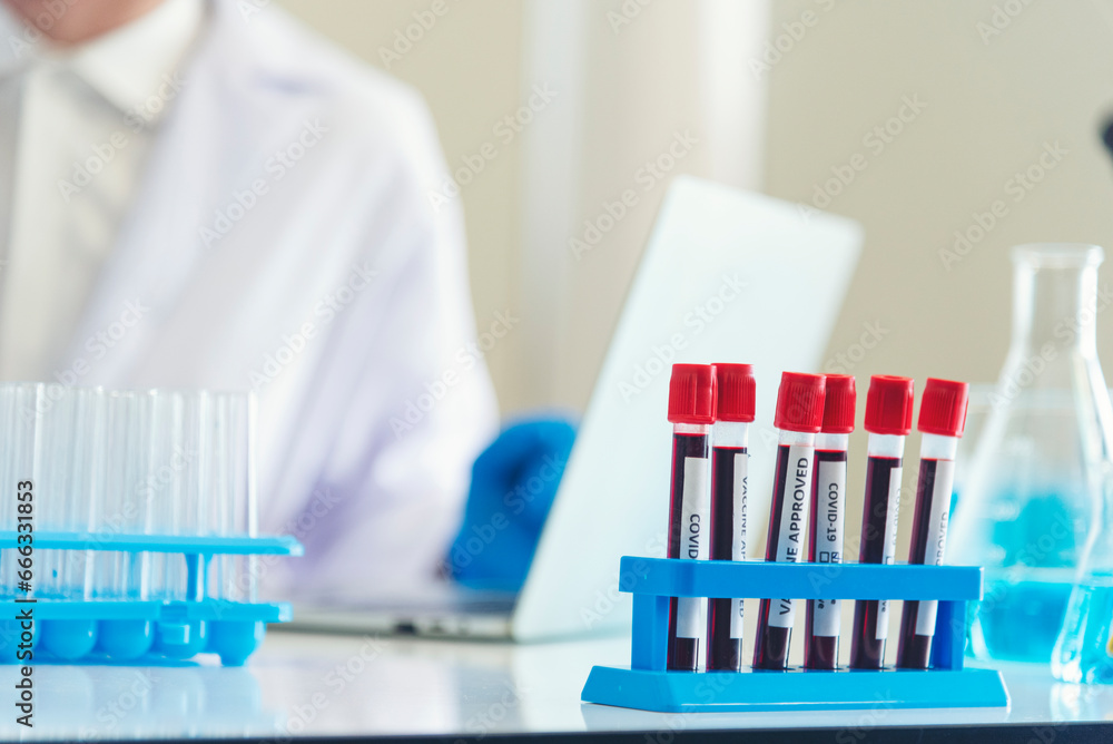 Science chemistry glass tubes objects on lab background. Liquid tube ...