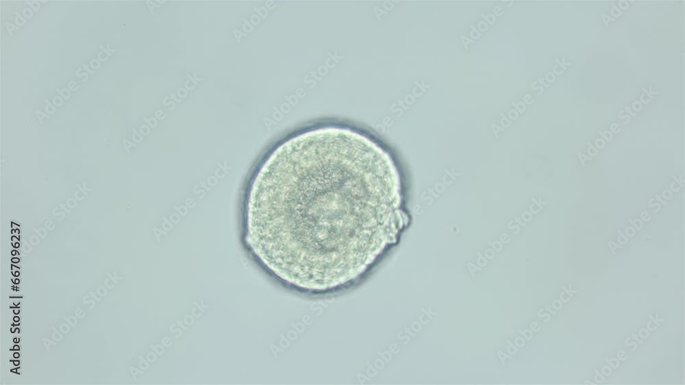 Larva sea urchin Strongylocentrotus pallidus under microscope, phylum ...