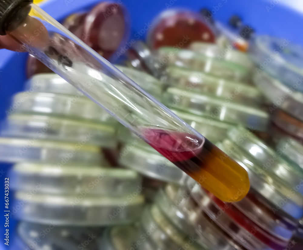 Triple Sugar Iron (TSI) Agar for the detection bacteria in microbiology ...