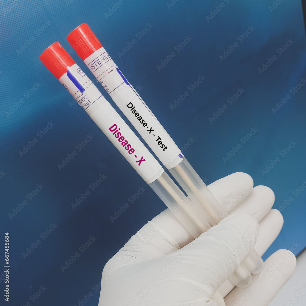 Swab sample for Disease X test. Disease X is the mysterious name given ...