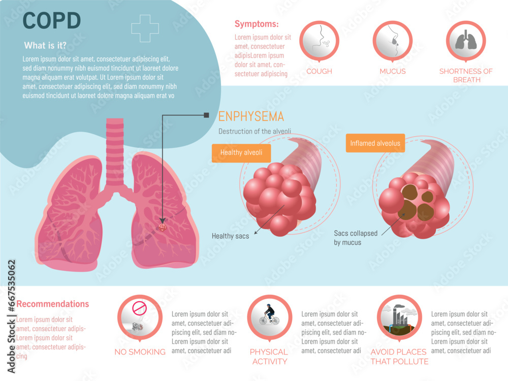 Infographic on chronic obstructive pulmonary disease, COPD, what it is ...