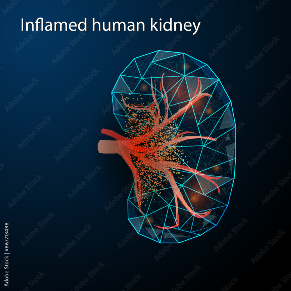Polygonal vector illustration of an inflamed human kidney on a dark ...