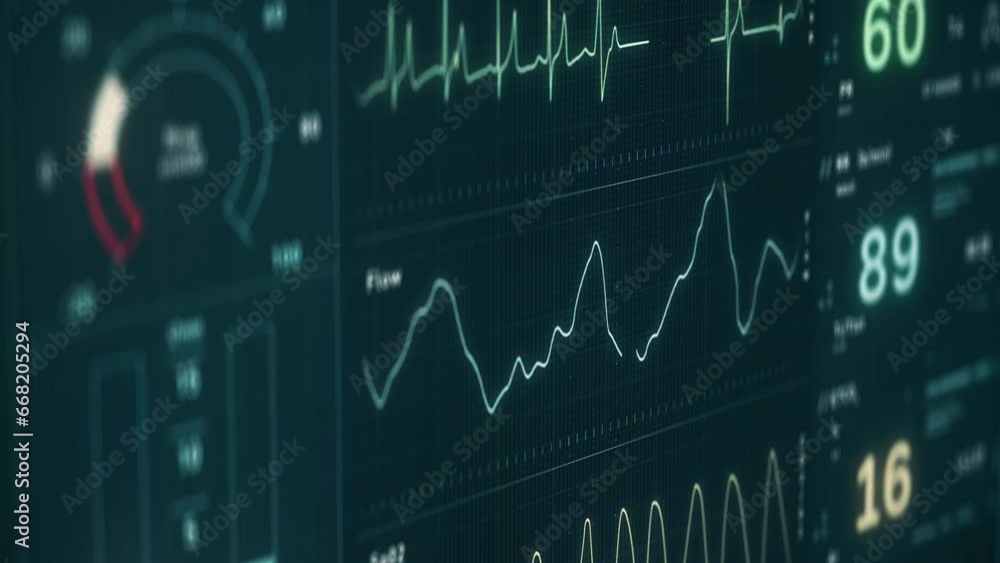 Medical Monitoring Dwindling Line Graph Shows Pulse Rate Decrease ...