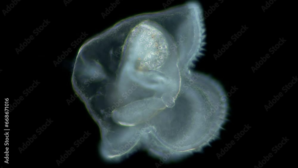 Pilidium larva of worm Heteronemertea under microscope, genus ...