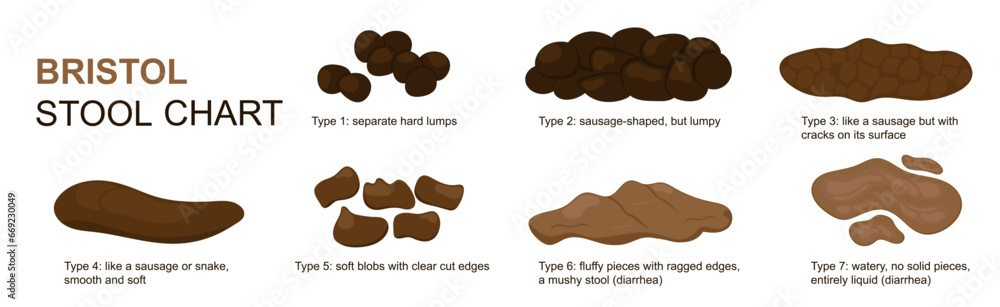 Bristol stool scale, stool types infographic. Set of different types human feces, excrement in ...