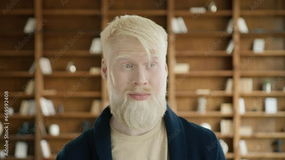 Closeup surprised face of albino man in the office. Blond guy moving ...