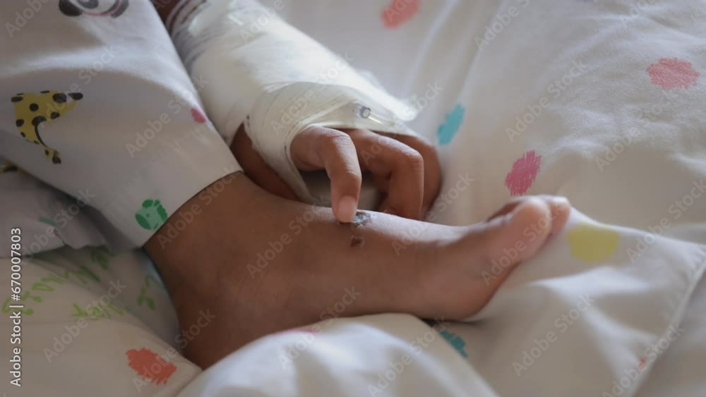 Sick child have a wound on her foot. She scratch her wound Stock-Video ...