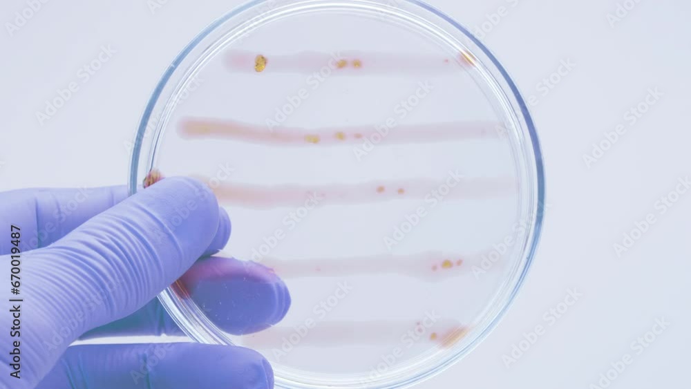 Explore the Fascinating World of Microbial Cultures in Microbiology Lab ...