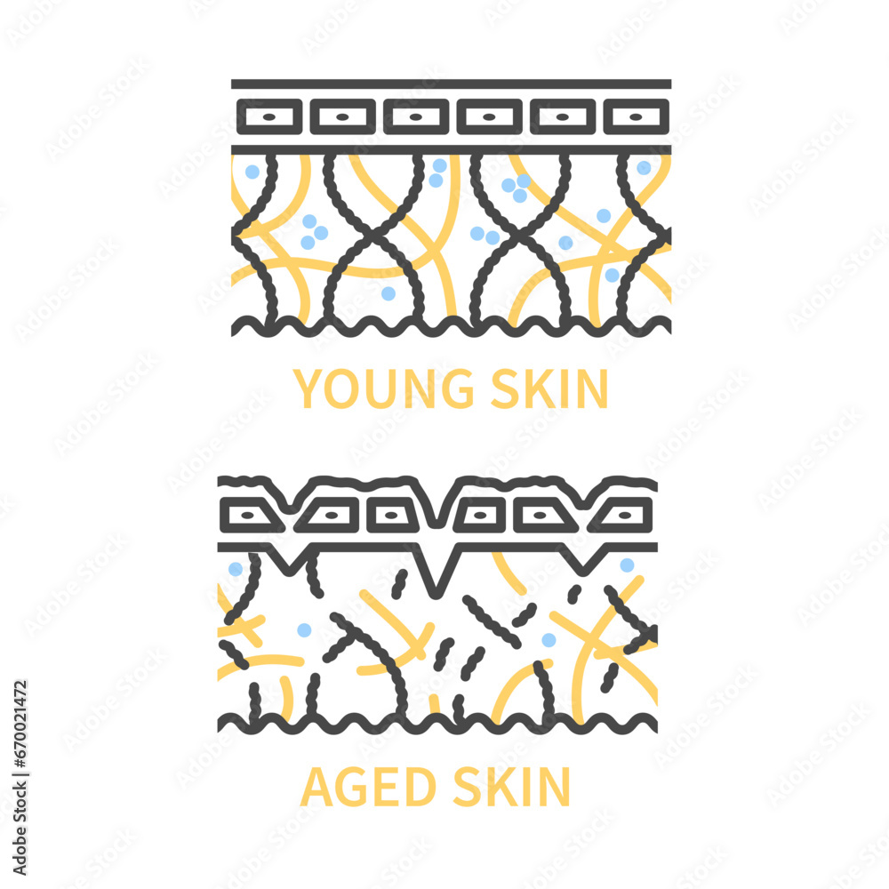 Young skin versus aging skin cross section diagram. Firm skin becoming ...