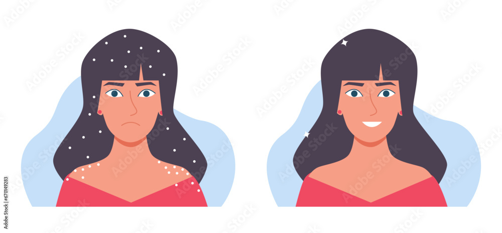 Sad woman with flake on head and shoulders and joyful woman without ...