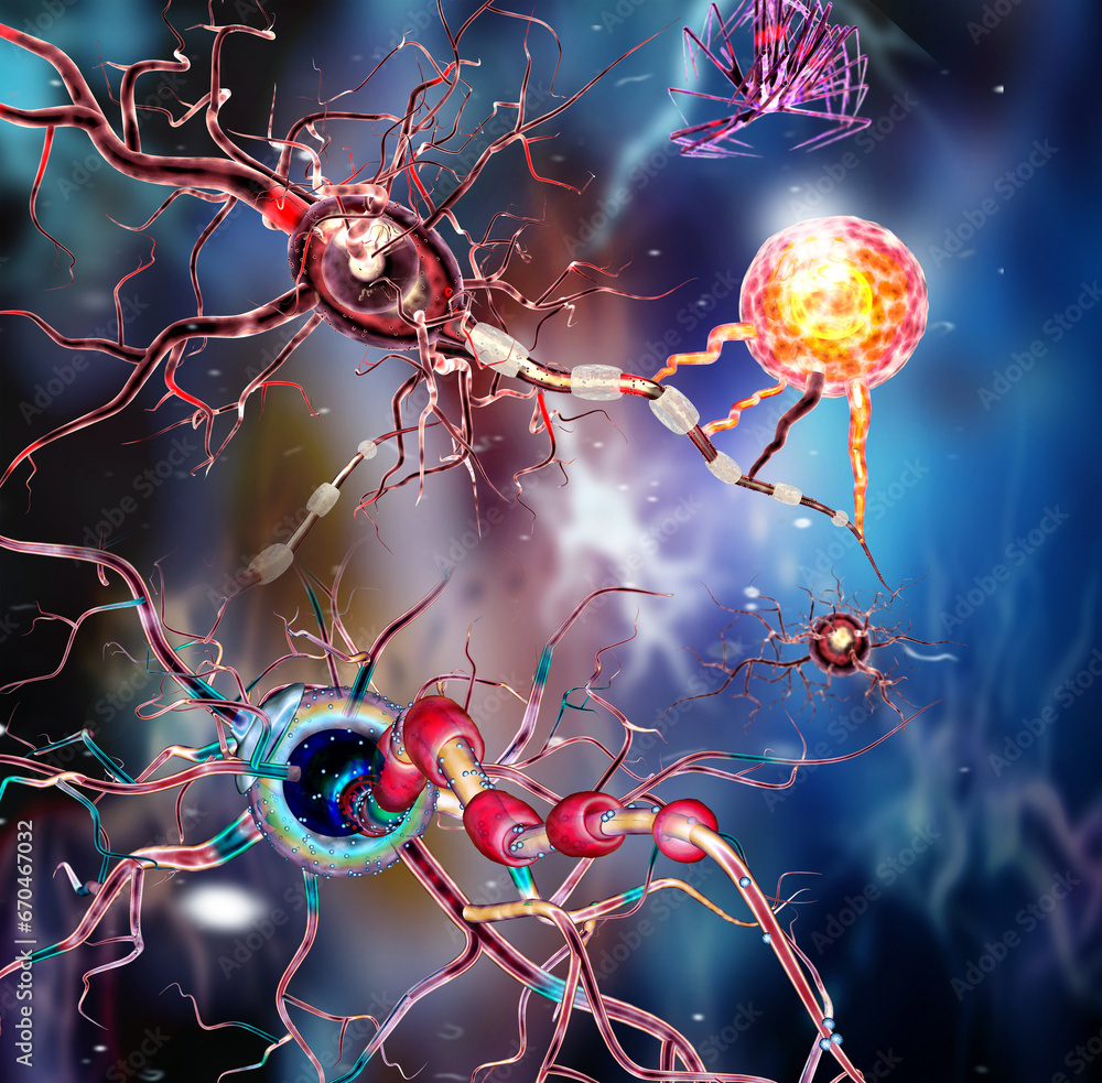 Nerve cells, Neuron, Neurologic Disease, tumors, brain surgery. 3d ...