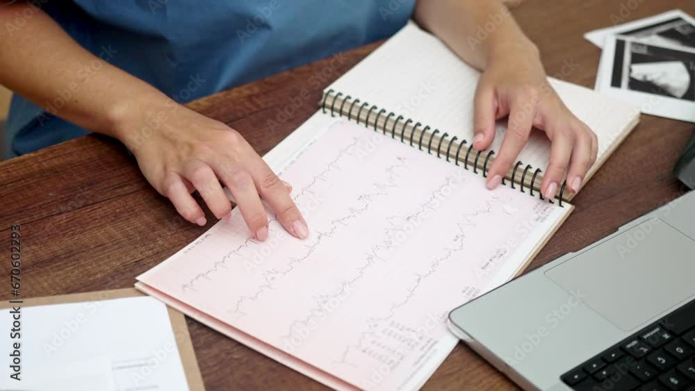 Cardiologist's ECG Analysis: In a close-up view, a cardiologist ...