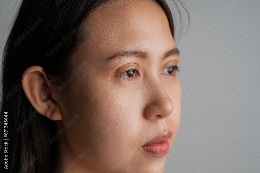 Foto de Asian woman with ongoing upper blepharoplasty surgery concept ...