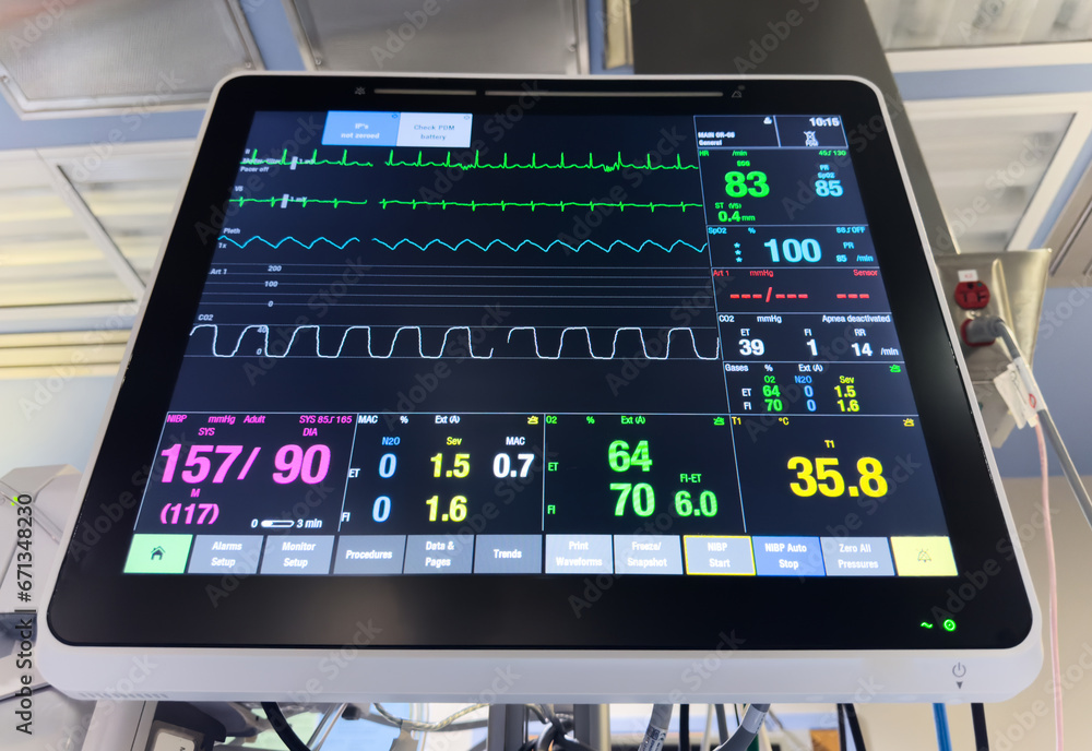hospital monitor displaying vital signs: blood pressure, heart rate ...