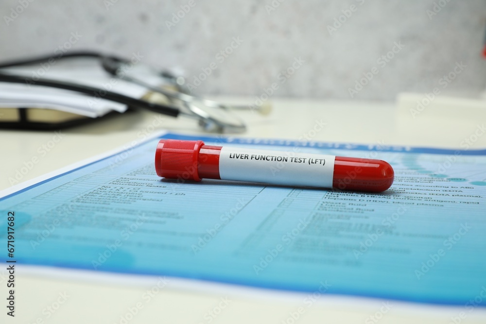 Liver Function Test. Tube with blood sample and form on white table ...