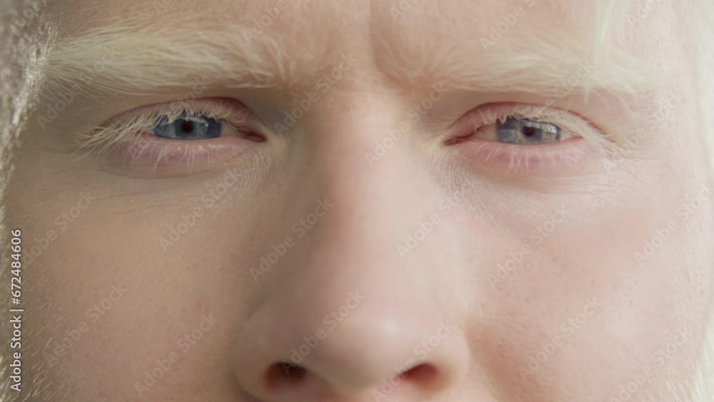 Marco close up blue eyes of handsome albino man. Calm relaxed man ...