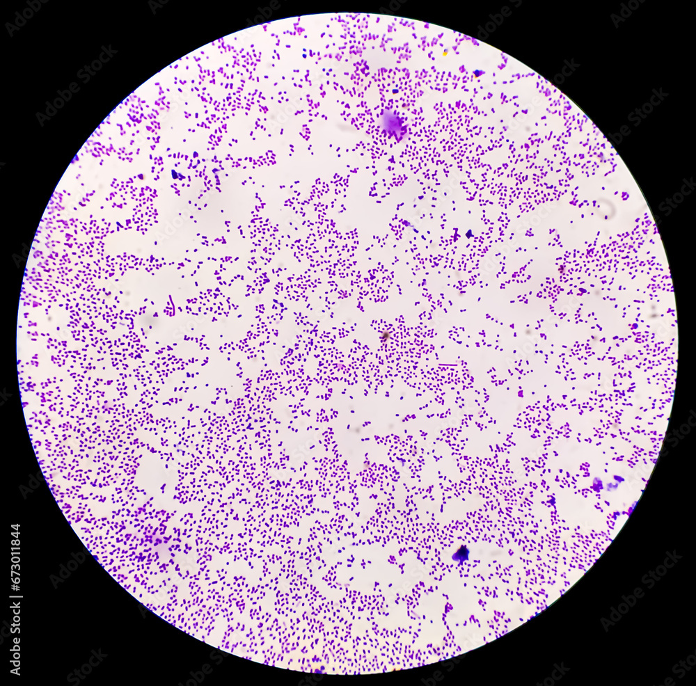 Poster Bacterial colonies gram stained microscopic show Staphylococcus ...