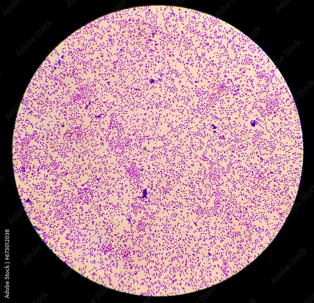 Bacteria colonies gram stained microscopic show Escherichia coli (E ...