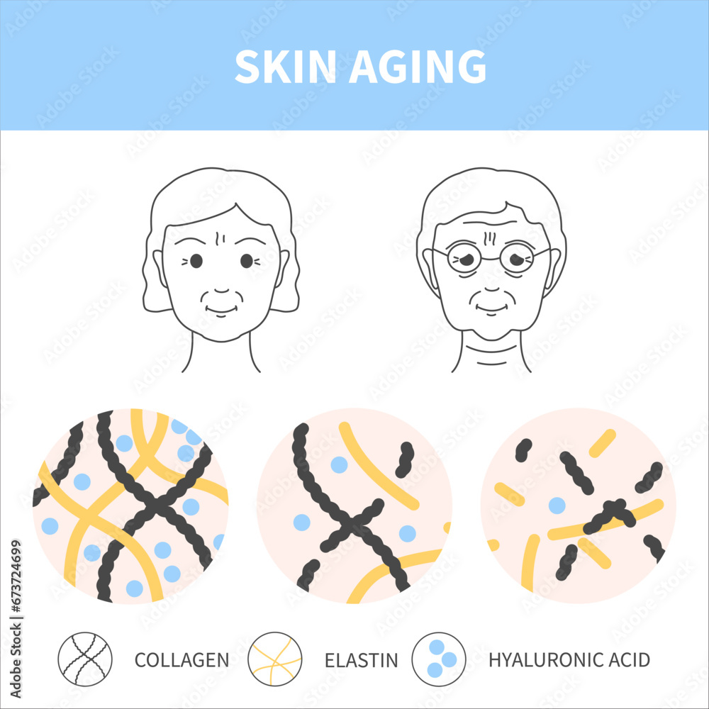 Skin aging process showing reduction of collagen, elastin and ...