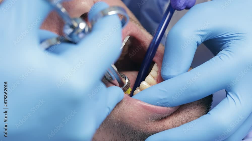 Dental surgeon injects an anesthetic into a patient before treating or ...