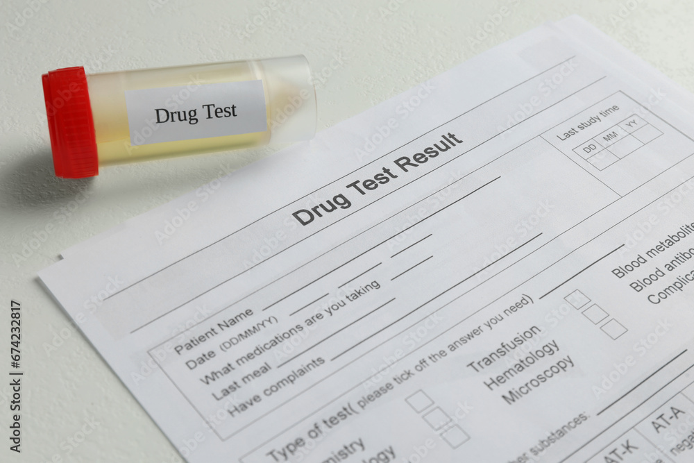 Drug test result form and container with urine sample on light table ...