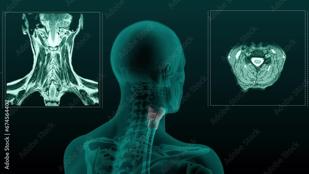 X-ray scan of the human head and neck with the Larynx visible. 3d ...
