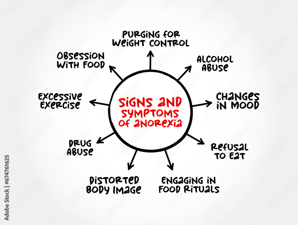 Signs and symptoms of Anorexia (eating disorder and serious mental ...