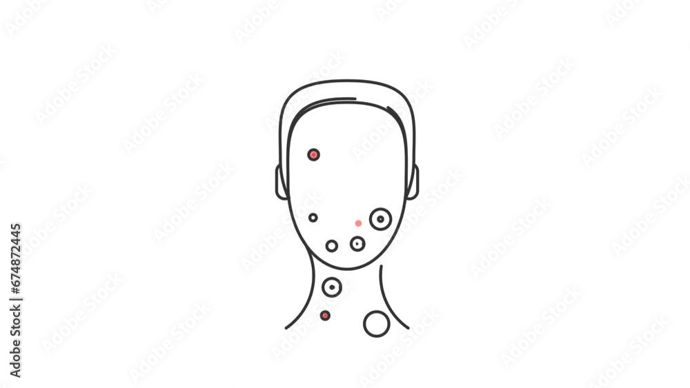 Skin Rashes And Spots As Symptoms Animated Icon As Mp4 File Vídeo De Stock Adobe Stock